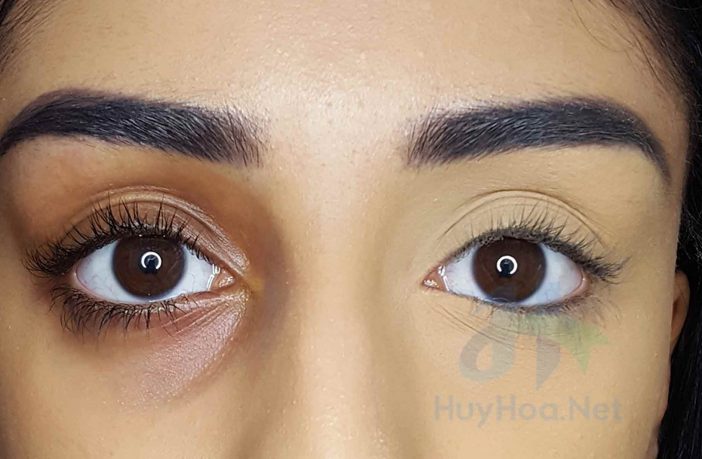 What Is The Average Forehead Size & How To Know If You Have A Big Forehead?