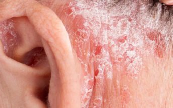 Rash Behind Ear: Causes, Symptoms, And Treatments